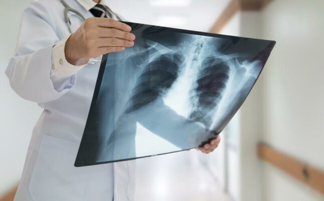 23 X-Ray Jokes & Puns You Absolutely Need To Scan